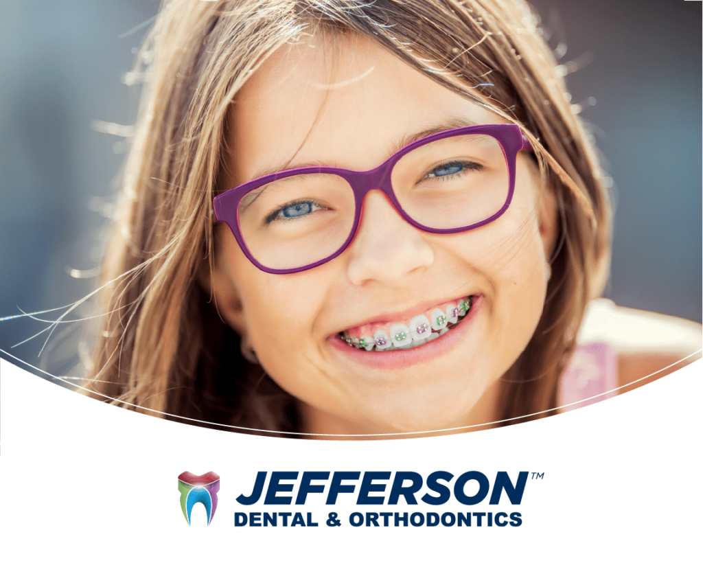 Braces Colors: How to Pick the Best Braces Color for Your Teeth ...